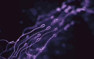Microfluidics Sperm Sorting Technique: Cost, Process & How it works